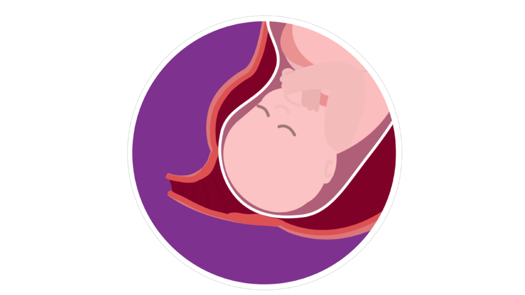 Definición - Fundaprem